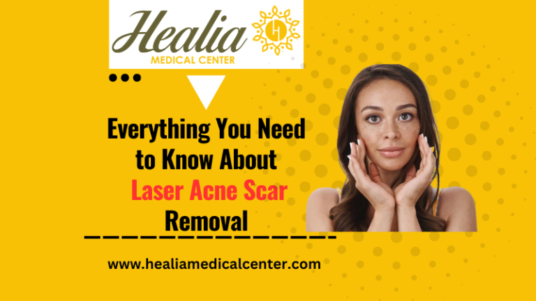 Everything You Need to Know About Laser Acne Scar Removal - Healia ...
